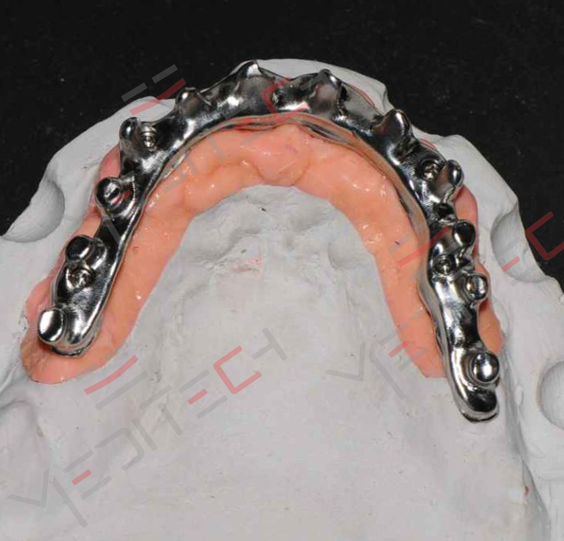 La protesi fissa tipo “Toronto Bridge” - Meditech Talk